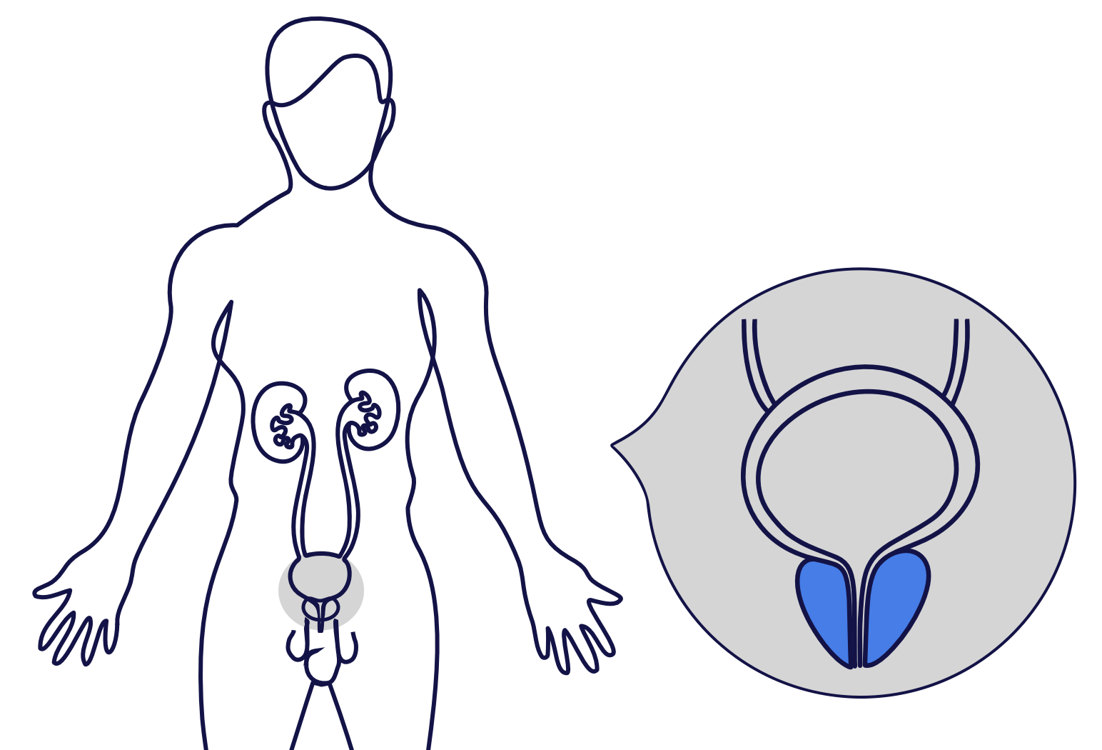 PSA Testing Brisbane Urology Clinic